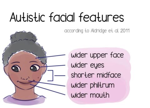 Facial Features of Autism - Autism Family Circus
