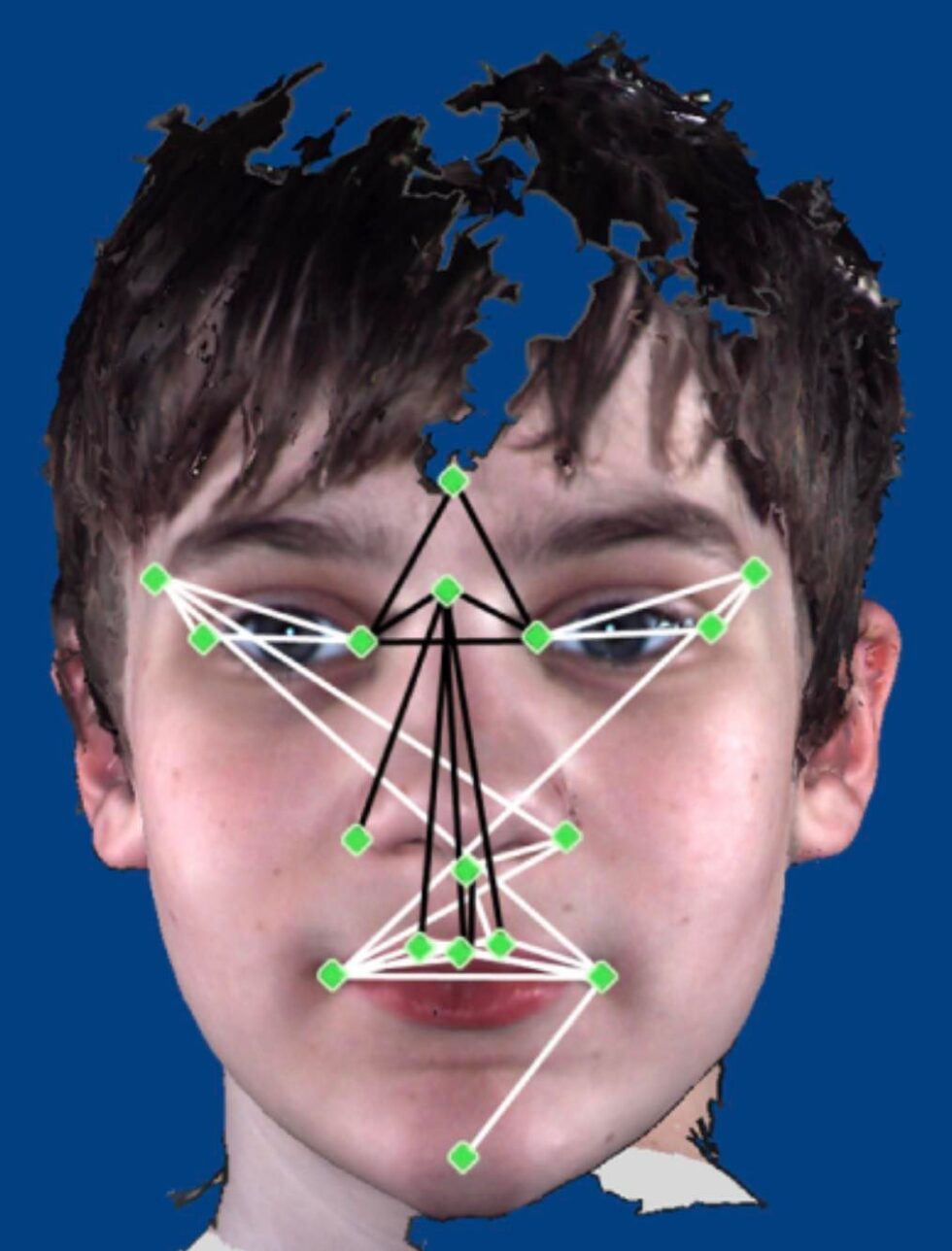 Facial Features of Autism - Autism Family Circus